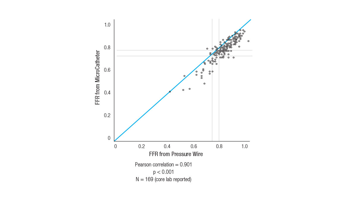 Rapid Exchange FFR System | RXi Mini FFR System & Navvus MicroCatheter | ACIST Medical